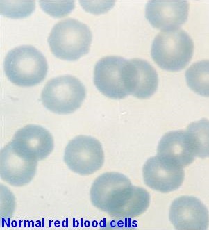 هماتولوژی دانشگاه علوم پزشکی ایلام | هفته سوم اردیبهشت ۱۳۹۵