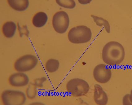 هماتولوژی دانشگاه علوم پزشکی ایلام | هفته سوم اردیبهشت ۱۳۹۵
