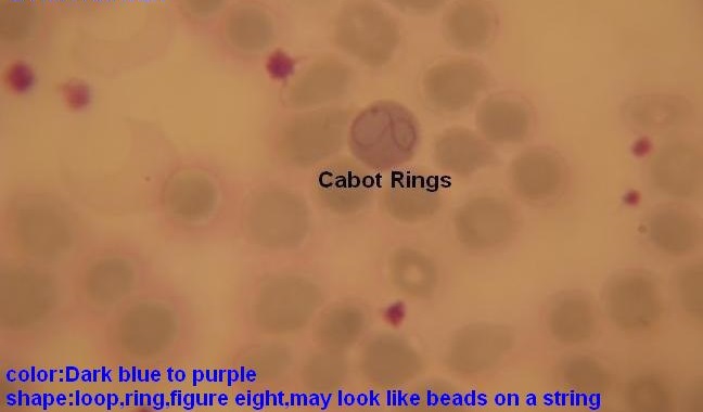 هماتولوژی دانشگاه علوم پزشکی ایلام | هفته سوم اردیبهشت ۱۳۹۵