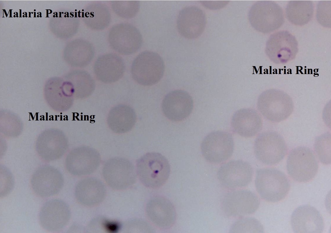 اطلس مرفولوژی گویچه های قرمز خون RBC Morphology