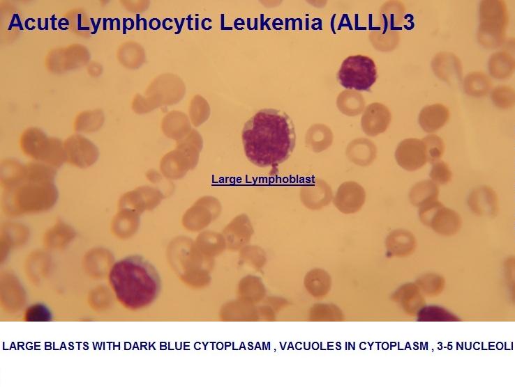 هماتولوژی دانشگاه علوم پزشکی ایلام | هفته سوم اردیبهشت ۱۳۹۵