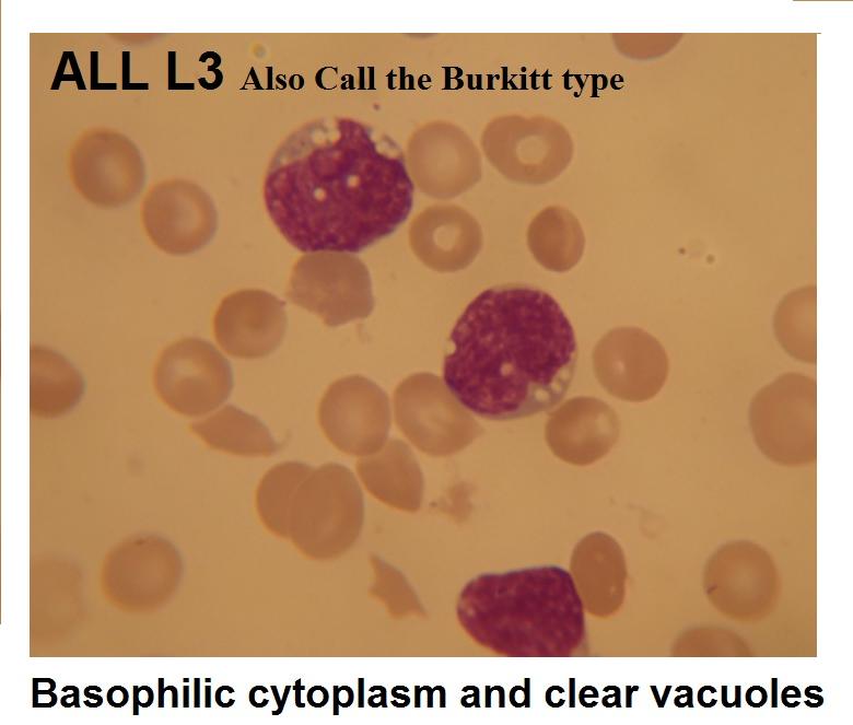 هماتولوژی دانشگاه علوم پزشکی ایلام | هفته سوم اردیبهشت ۱۳۹۵